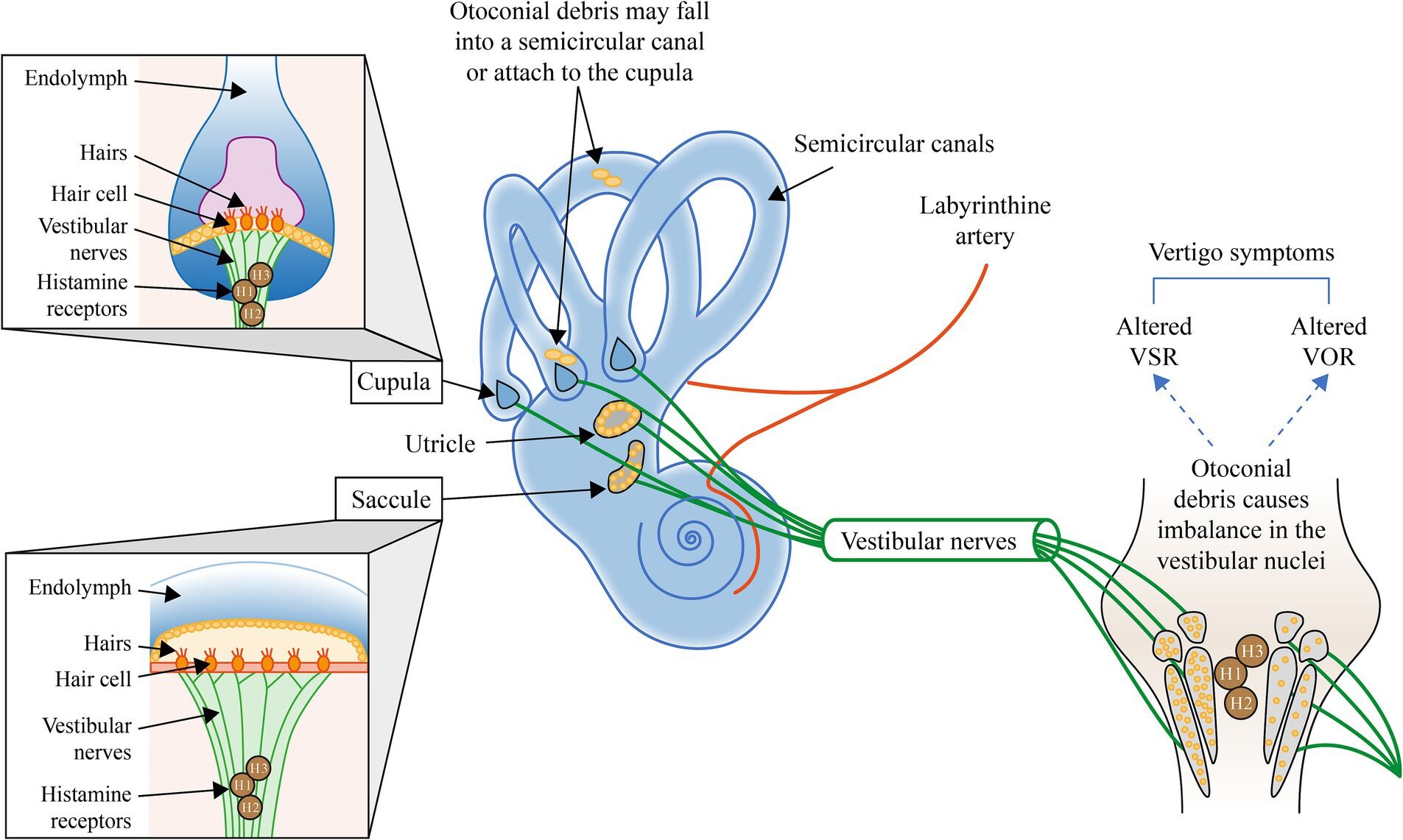 Diuretics May Impact BPPV Risk Based on Patient History and Drug Class ...