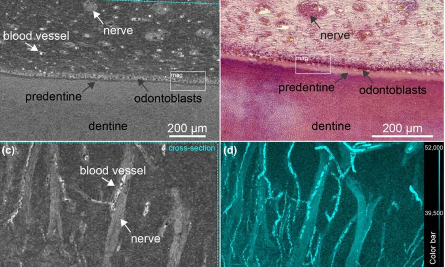 From pulp to cementum: 3D visualization of soft and hard dental tissues ...