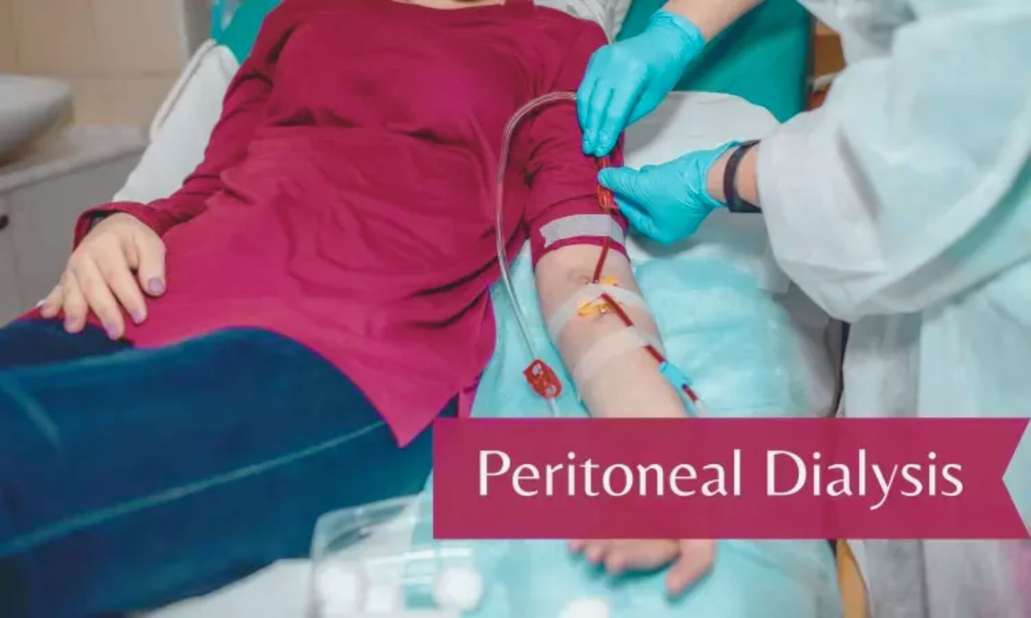 Validated nomogram may Predict upper GI bleeding in peritoneal dialysis ...
