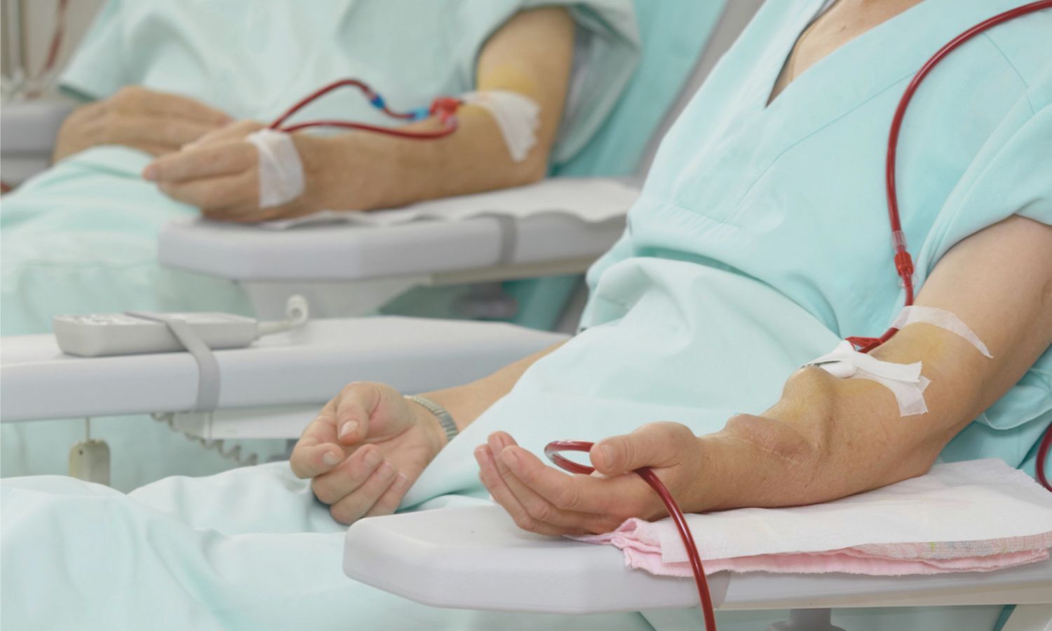 Chlorhexidine Outperforms Ethanol in Preventing AVF Infections During ...