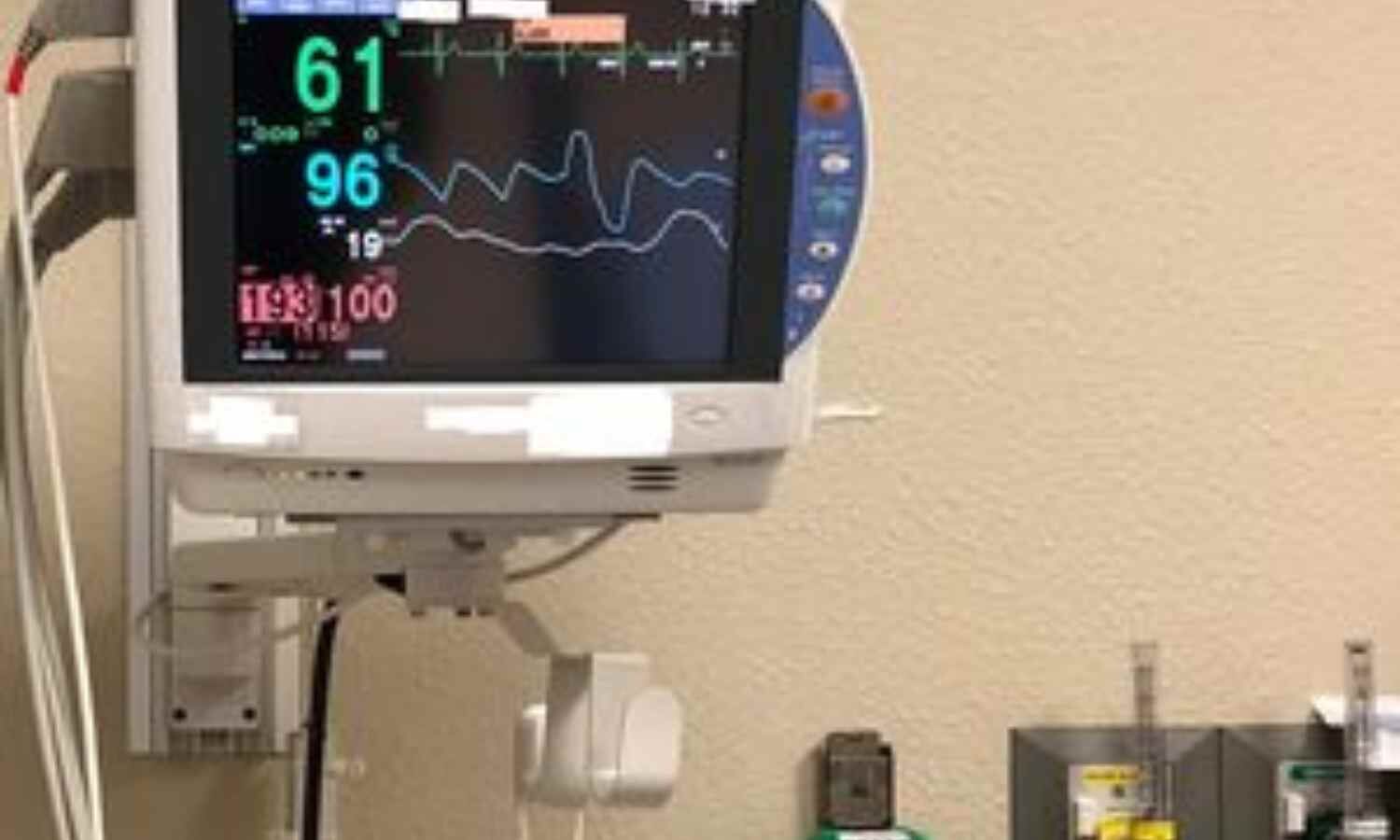 Predicting the Unpredictable: Study finds Insights into Intraoperative ...