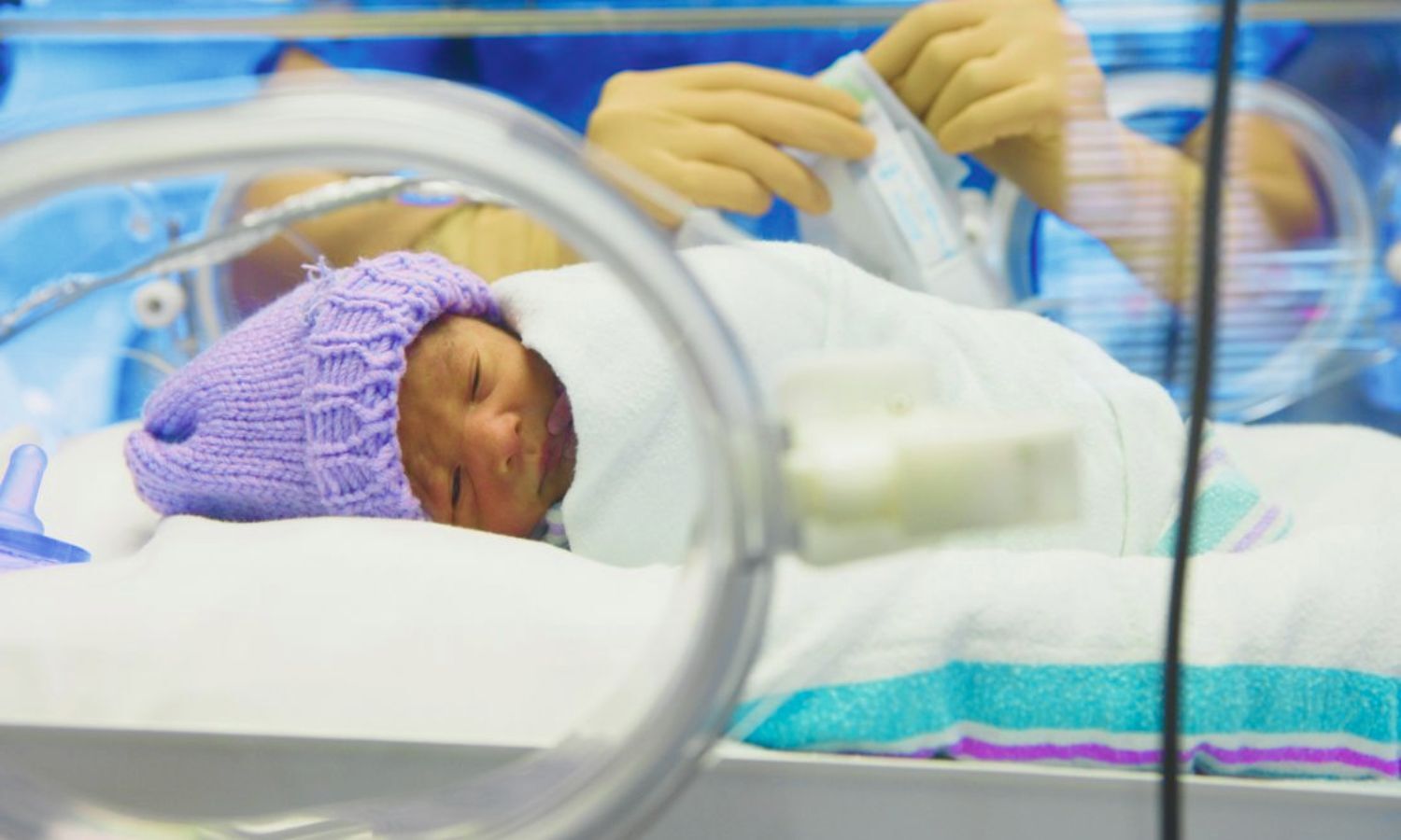 Dynamic Model Predicts Individualized Benefits and Risks of Platelet ...