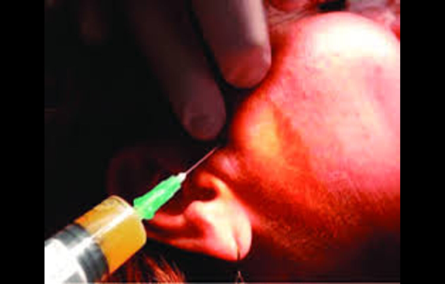 Individualized approach for intra-Articular Injections effective for ...