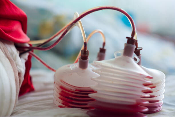 Suction Drains in Joint Replacement Surgery Leads to Higher Blood Loss ...
