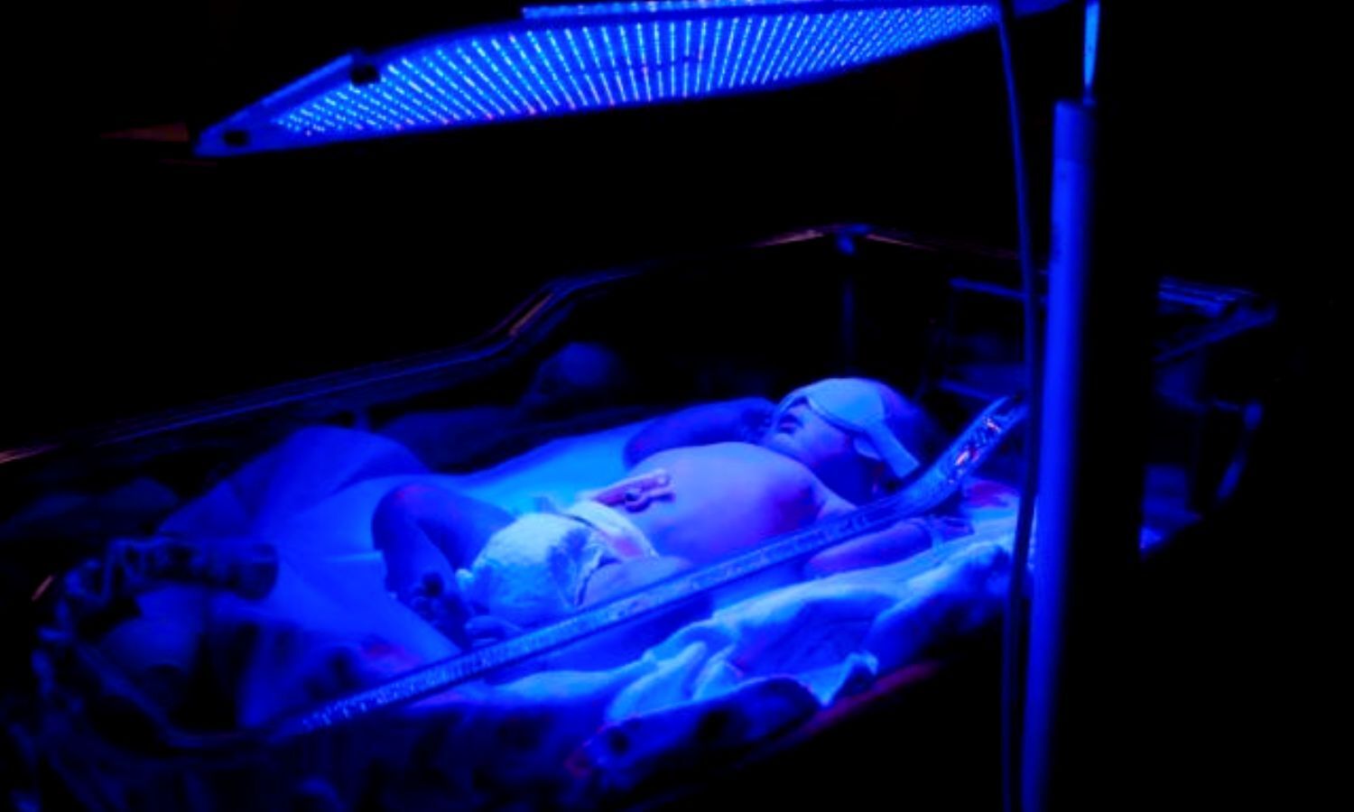 Intermittent Blue Light Therapy Outperforms Continuous Treatment for ...