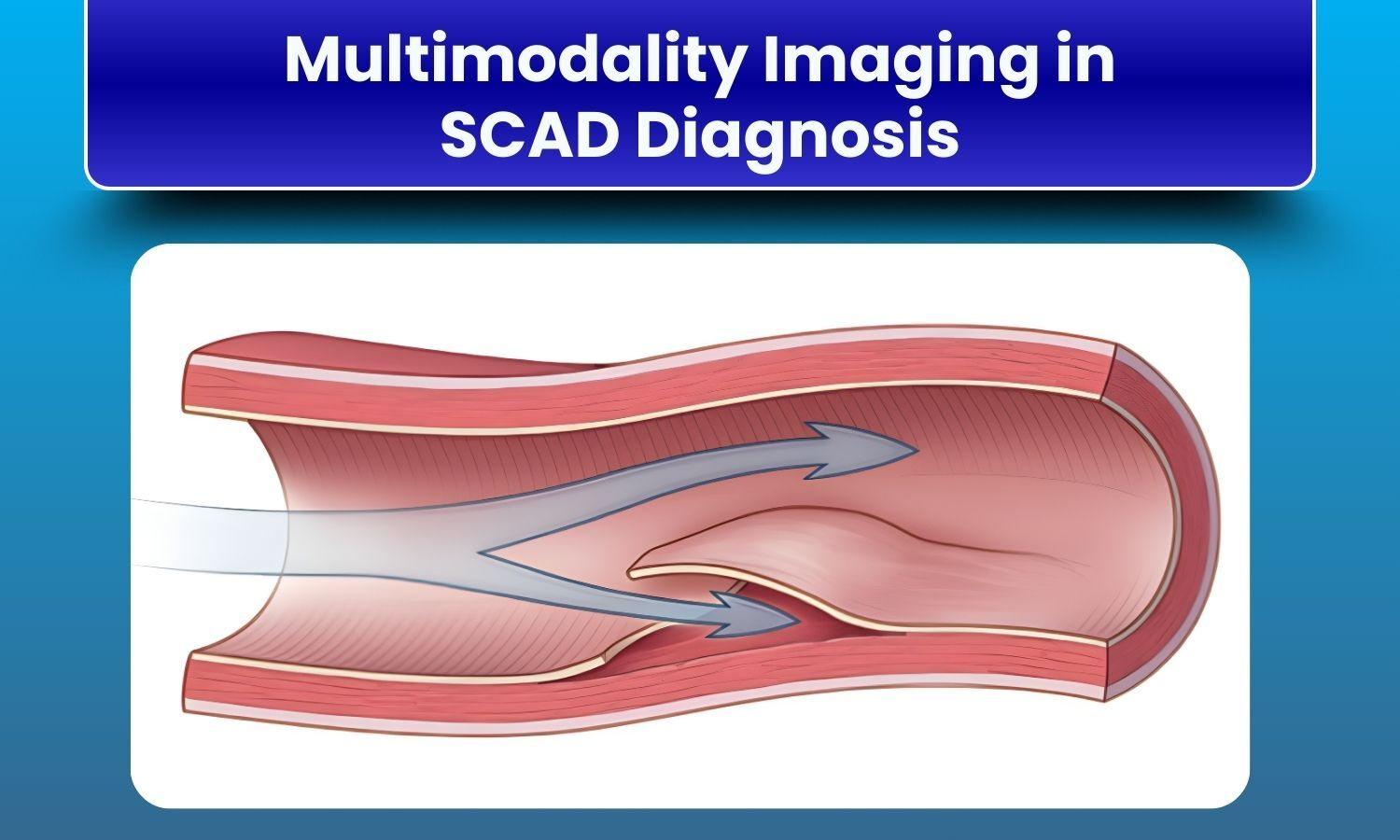 Systematic Review Highlights Multimodality Imaging Essential for ...