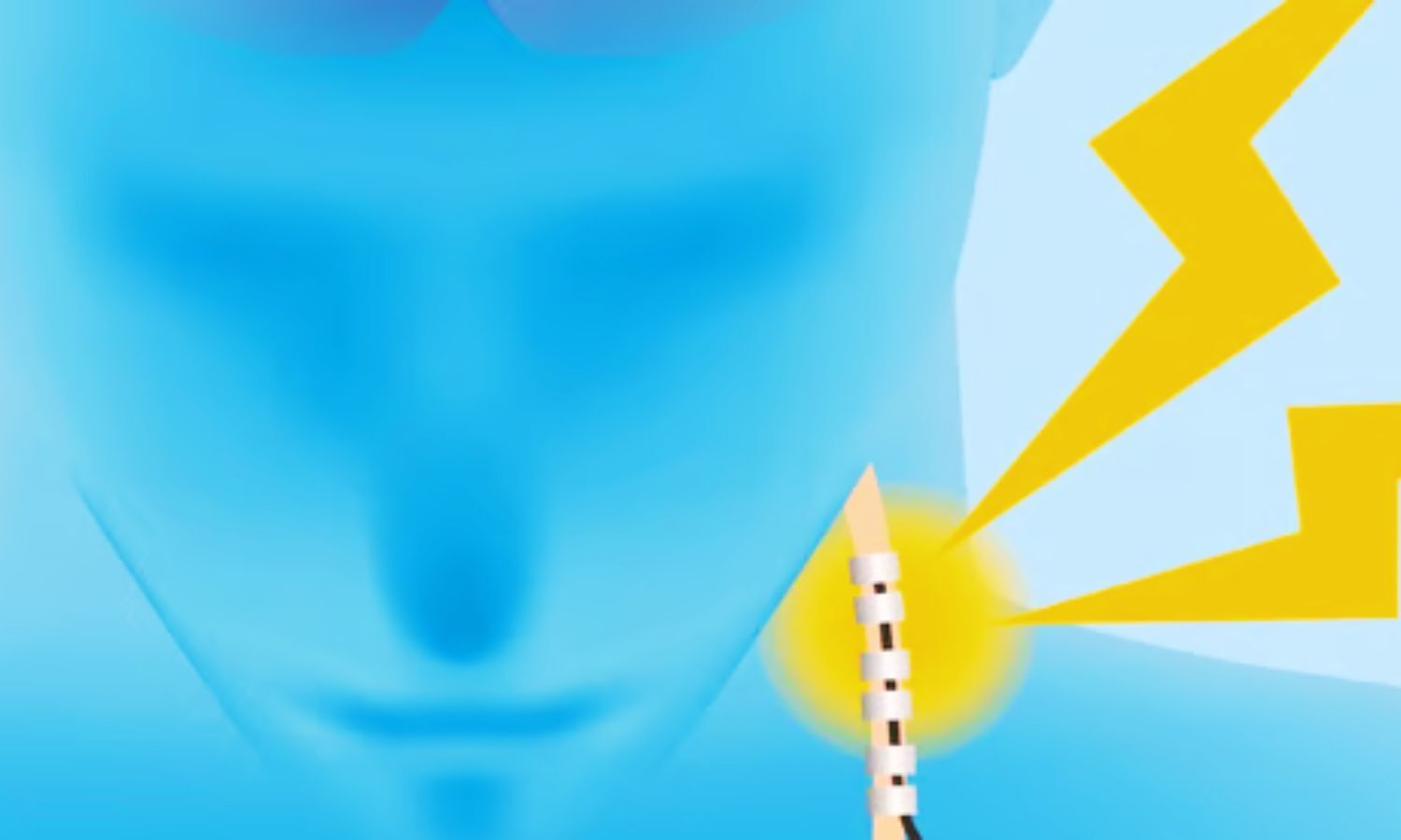 Vagus Nerve Stimulation Shows Promising Clinical Response in Rheumatoid ...