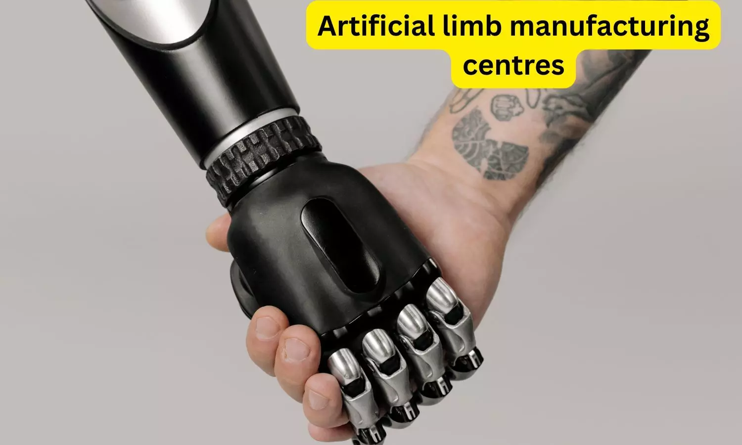 Andhra Pradesh: 5 Govt Teaching Hospitals to set up artificial limb ...