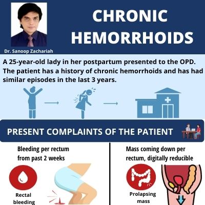 World Piles Day - Everything about piles from diagnosis to Hemorrhoidal ...
