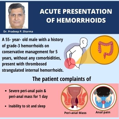 World Piles Day - Everything about piles from diagnosis to Hemorrhoidal ...