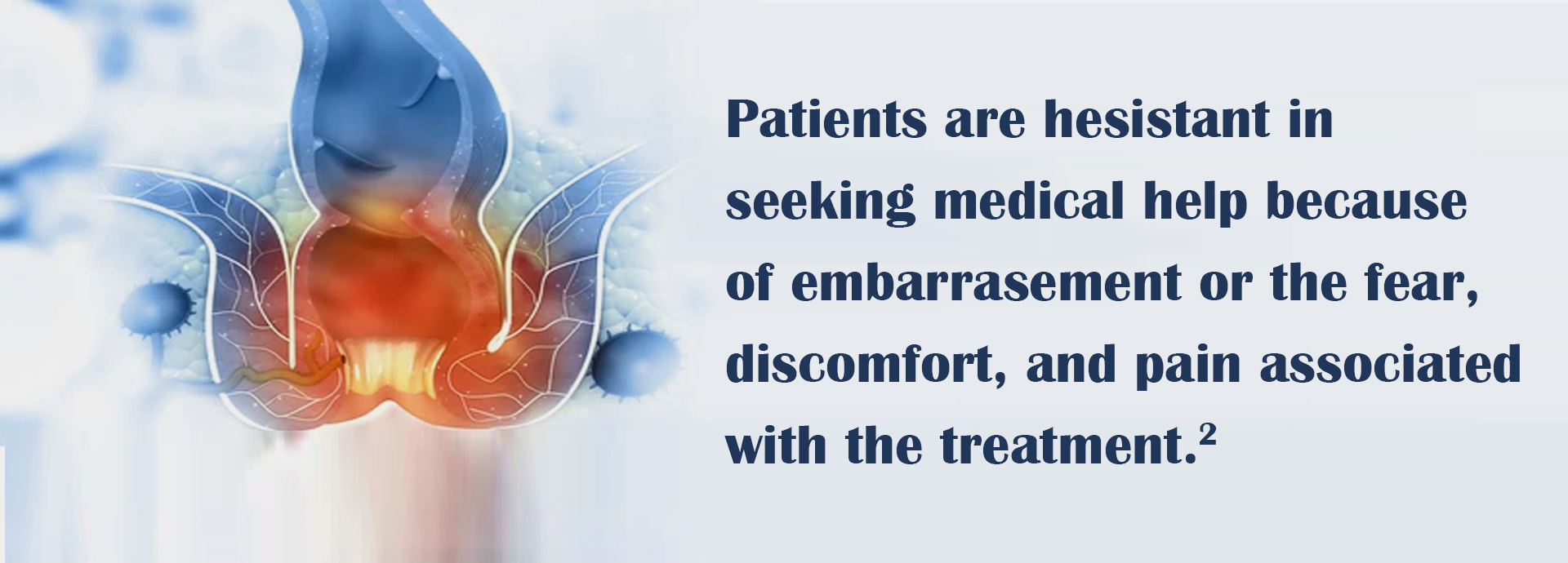 World Piles Day - Everything about piles from diagnosis to Hemorrhoidal ...